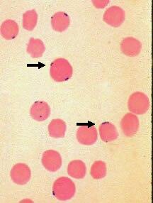 Clinical pathologist's interpretation